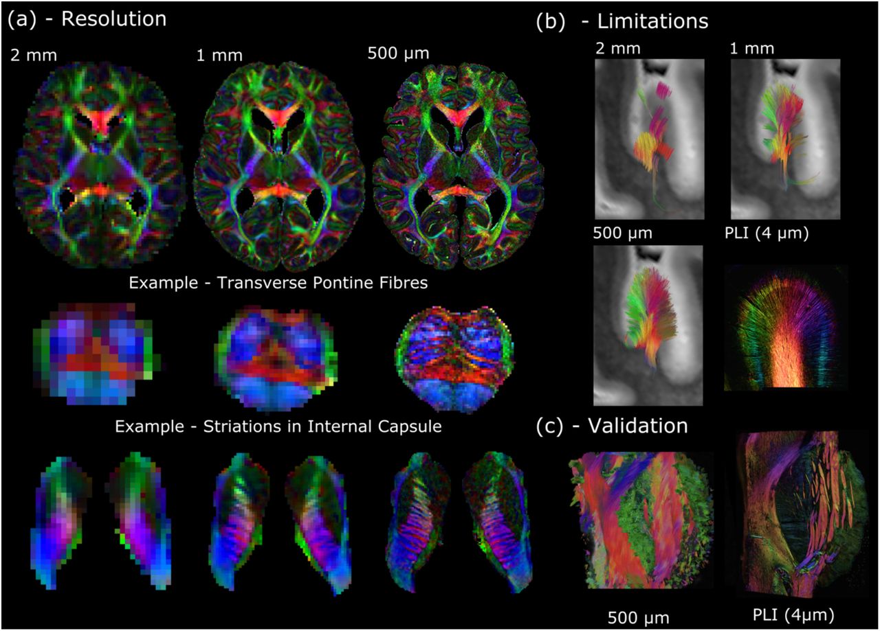 The Digital Brain Bank, an open access platform for post-mortem ...